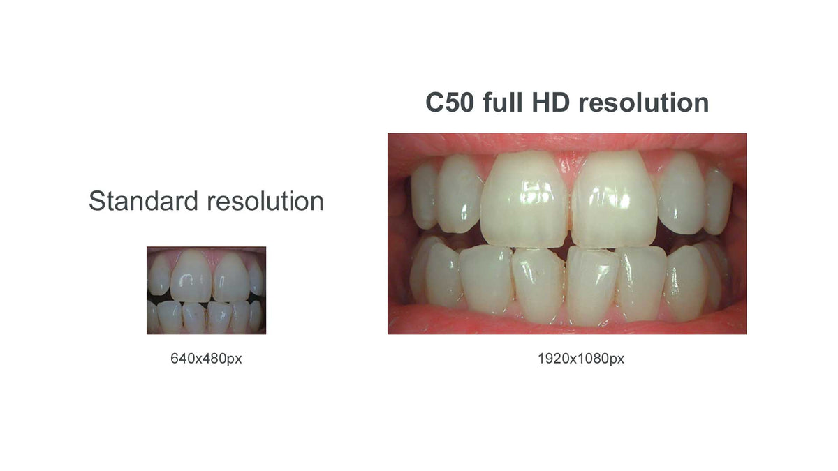 Acteon C50 Intra-oral Full HD Camera with diagnostic aid – Dental ...